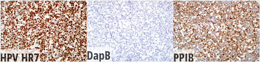 RNAscope on Our HPV Control Slides - HistoCyte
