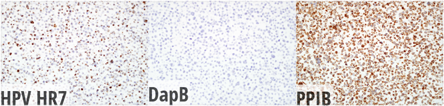 RNAscope on Our HPV Control Slides - HistoCyte