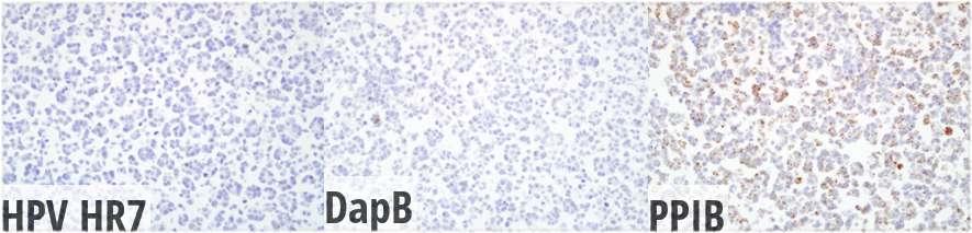 RNAscope on Our HPV Control Slides - HistoCyte