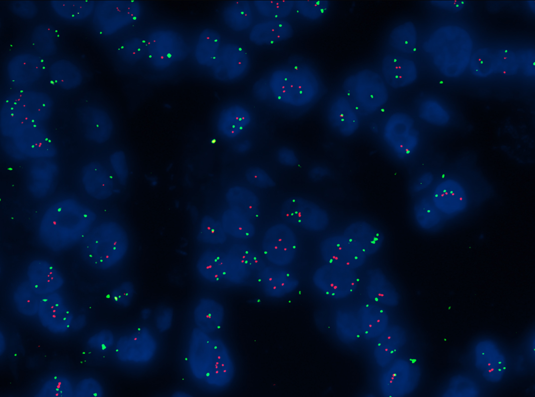 HER2 Analyte ControlDR - HistoCyte