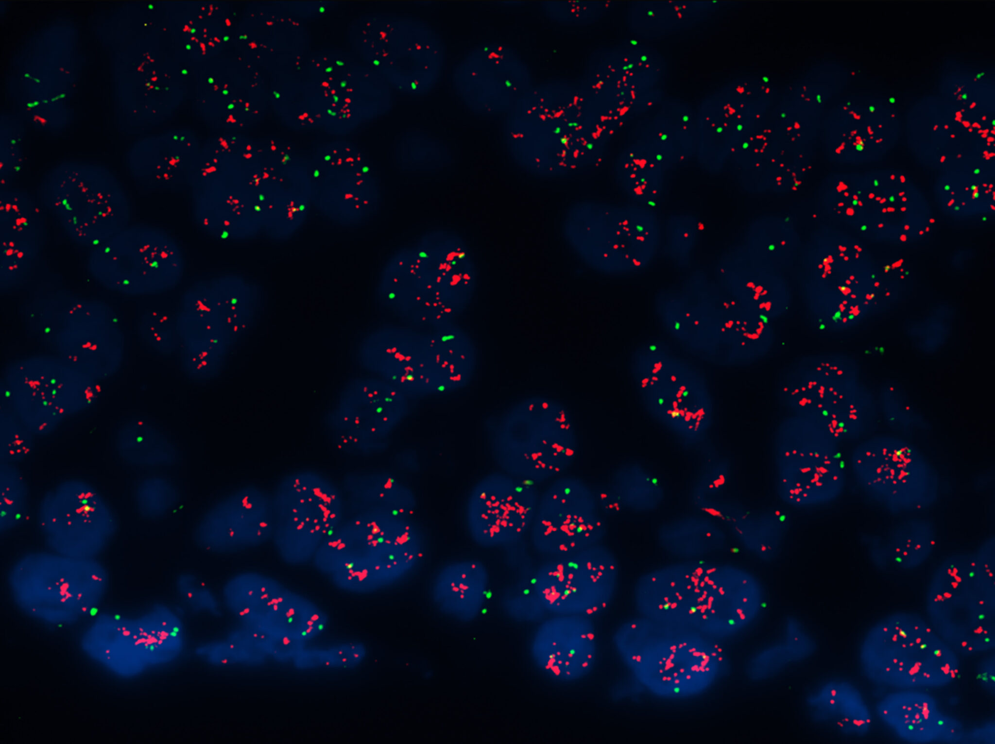 HER2 Analyte ControlDR - HistoCyte
