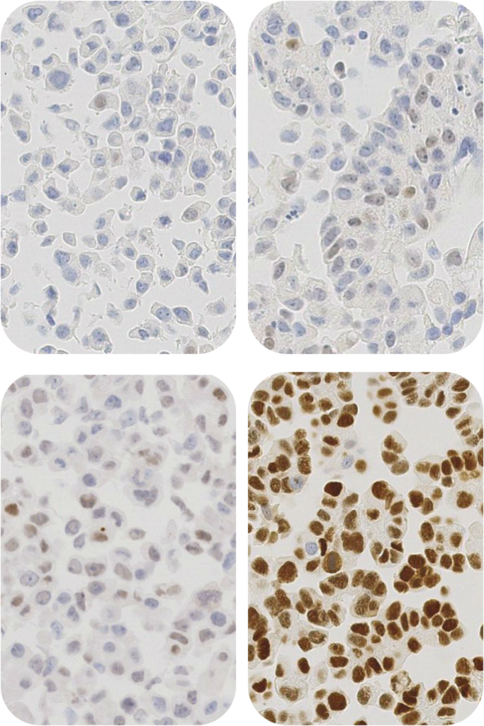 ER Analyte ControlDR - HistoCyte