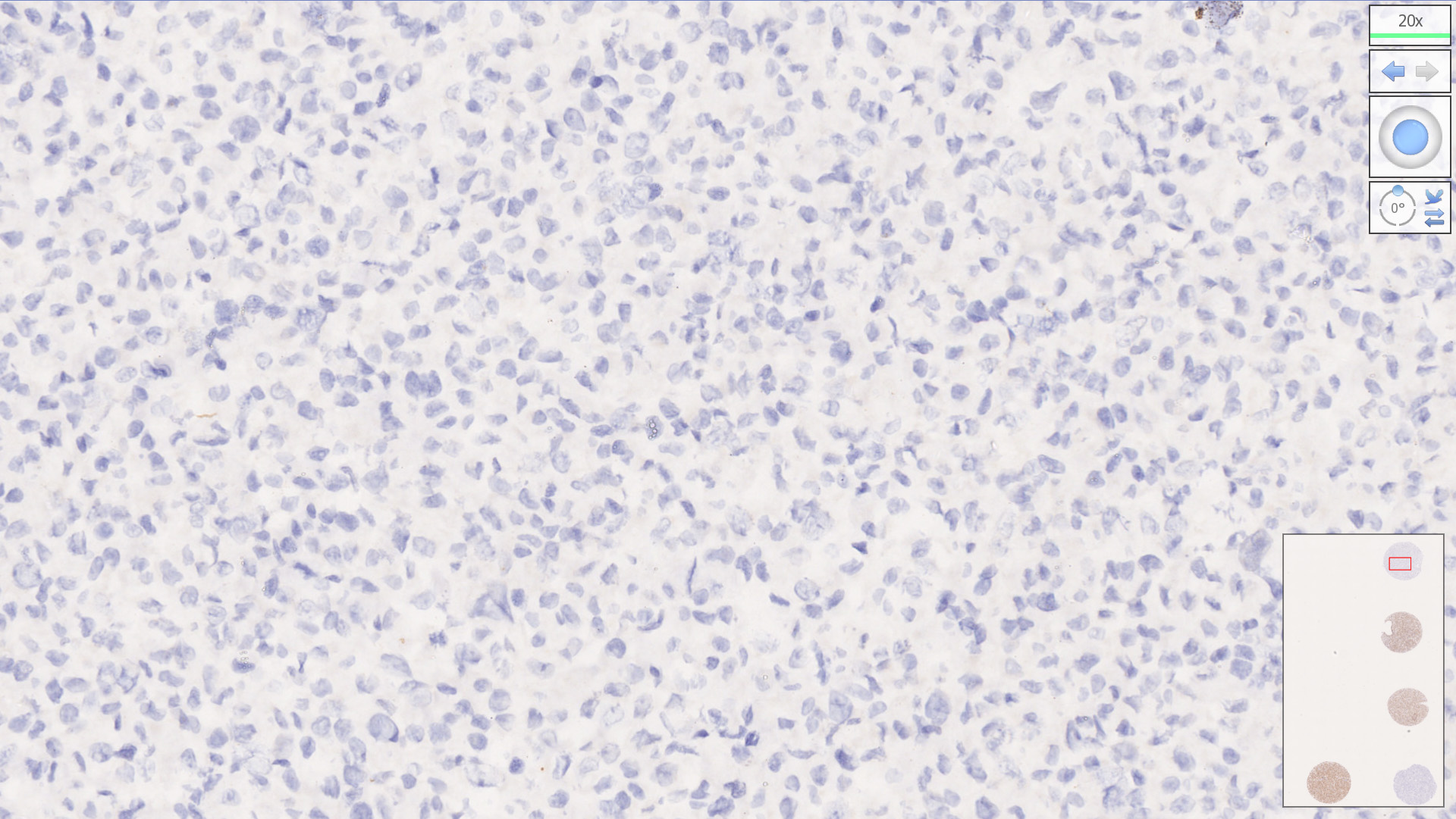 MLH1/PMS2 Analyte Control - HistoCyte