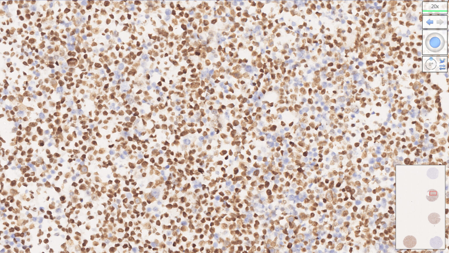 MMR Analyte Control - HistoCyte