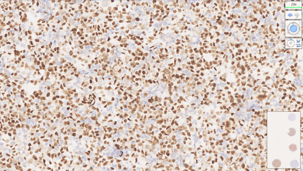 MMR Analyte Control - HistoCyte