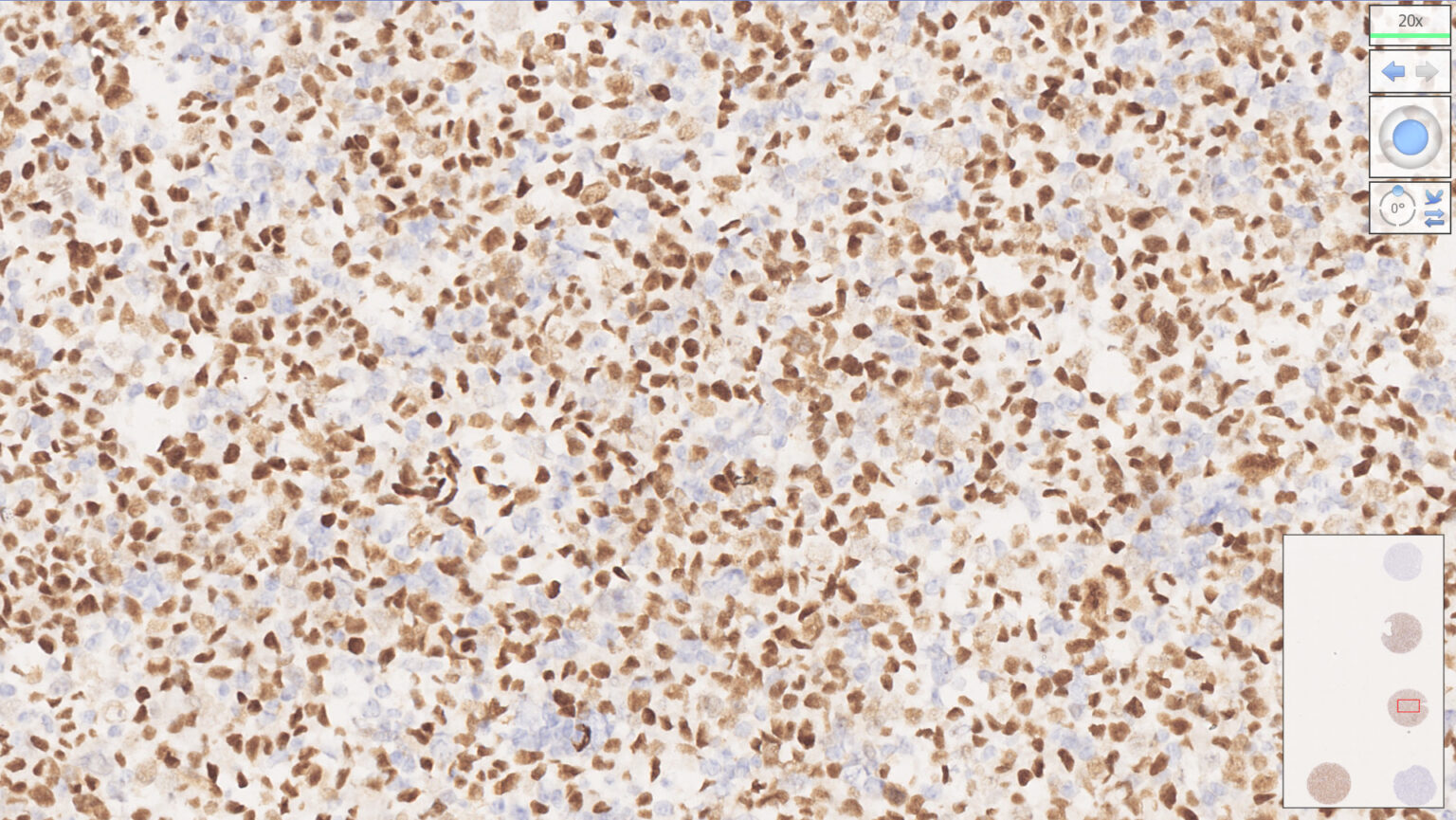 MMR Analyte Control - HistoCyte