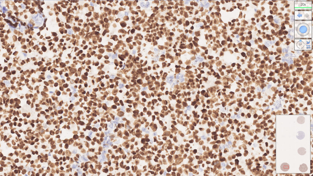 MMR Analyte Control - HistoCyte