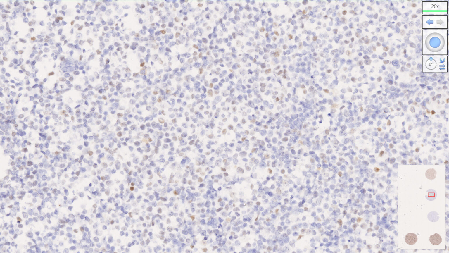 MMR Analyte Control - HistoCyte