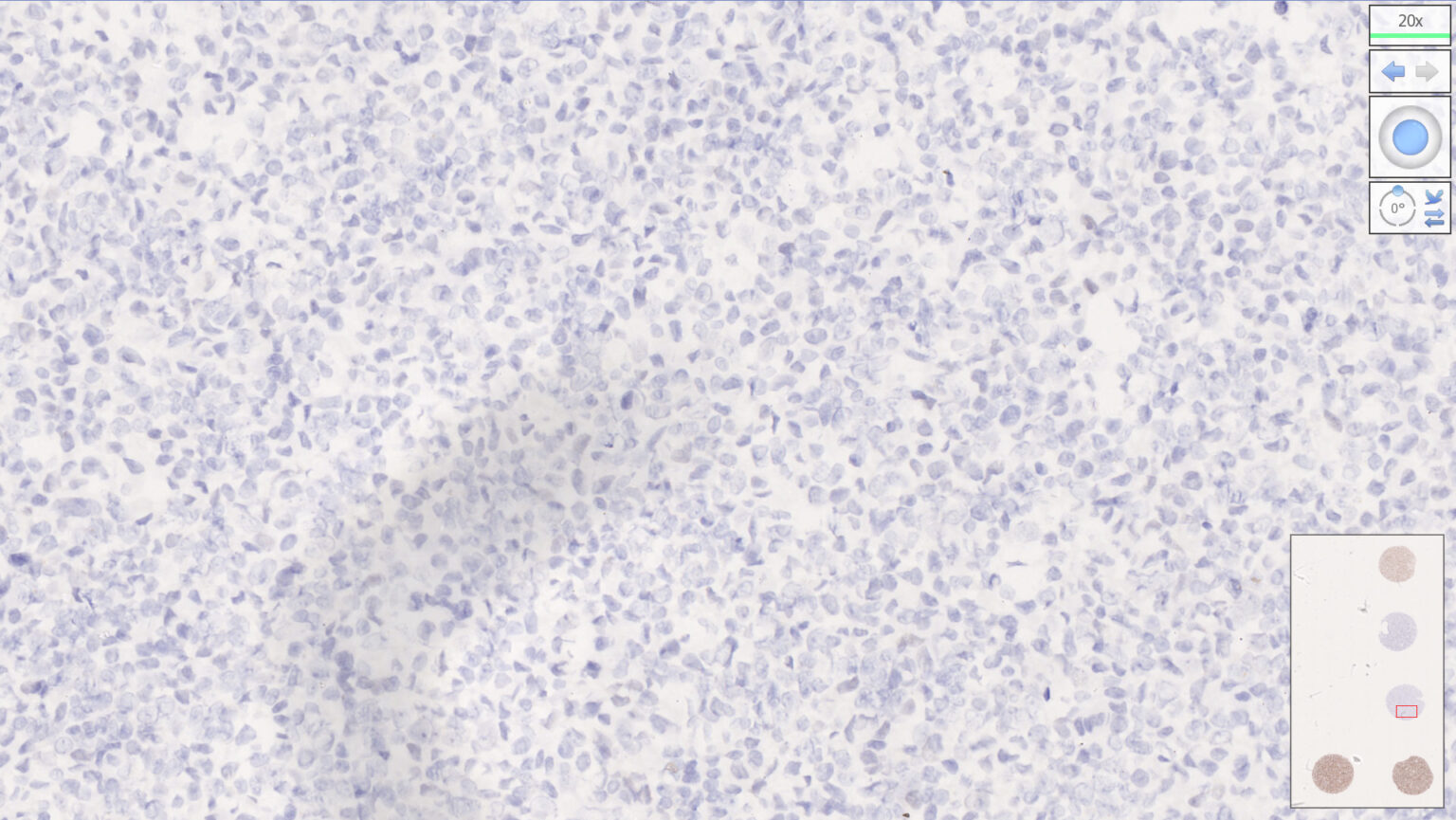 MMR Analyte Control - HistoCyte