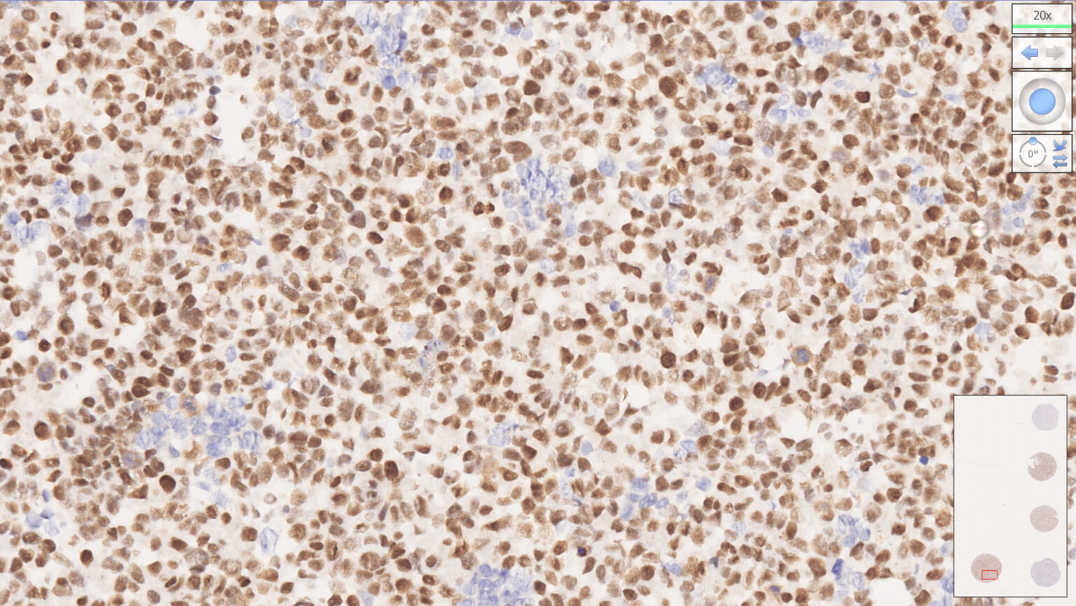 MMR Analyte Control - HistoCyte