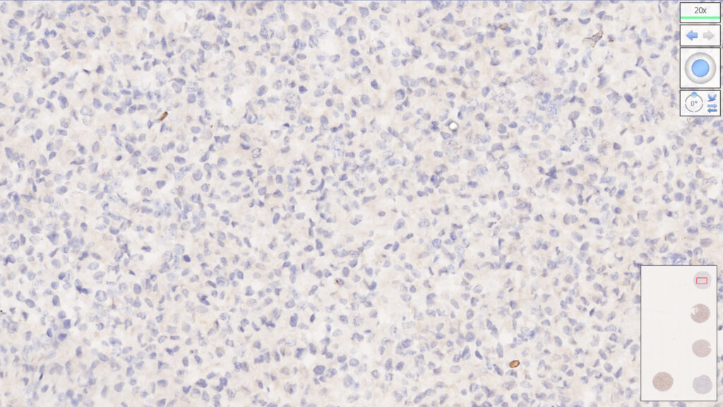 MLH1/PMS2 Analyte Control - HistoCyte