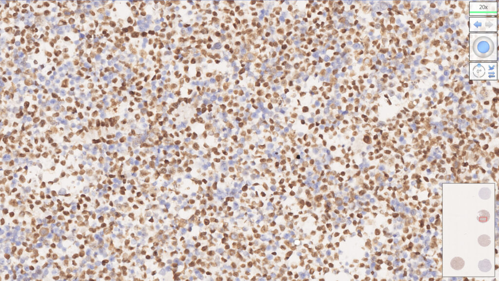 MMR Analyte Control - HistoCyte