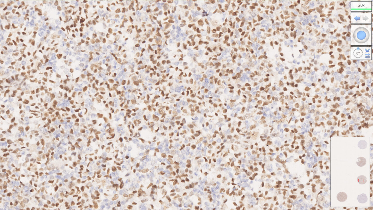 MMR Analyte Control - HistoCyte