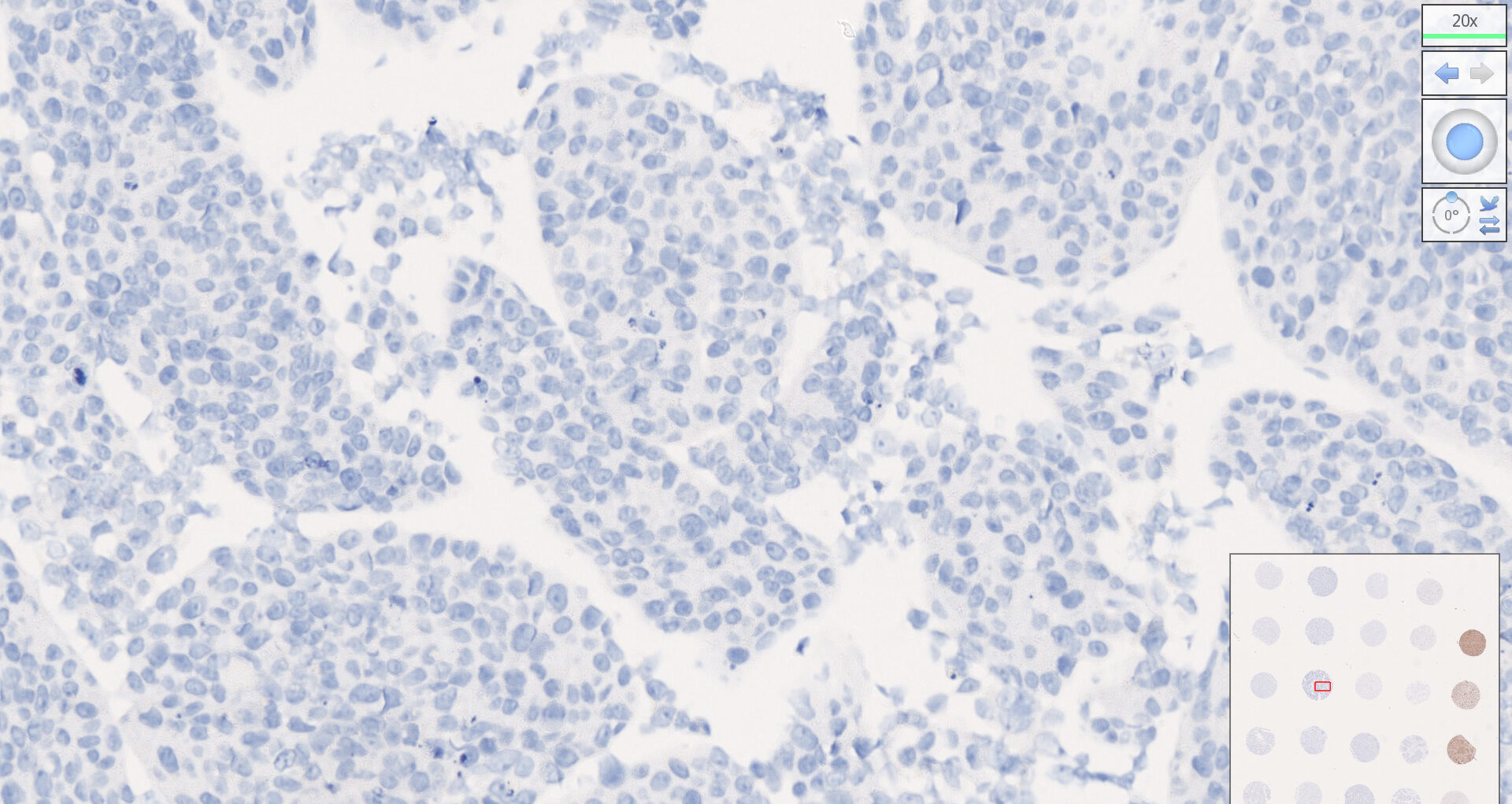 ALK Analyte ControlDR - HistoCyte