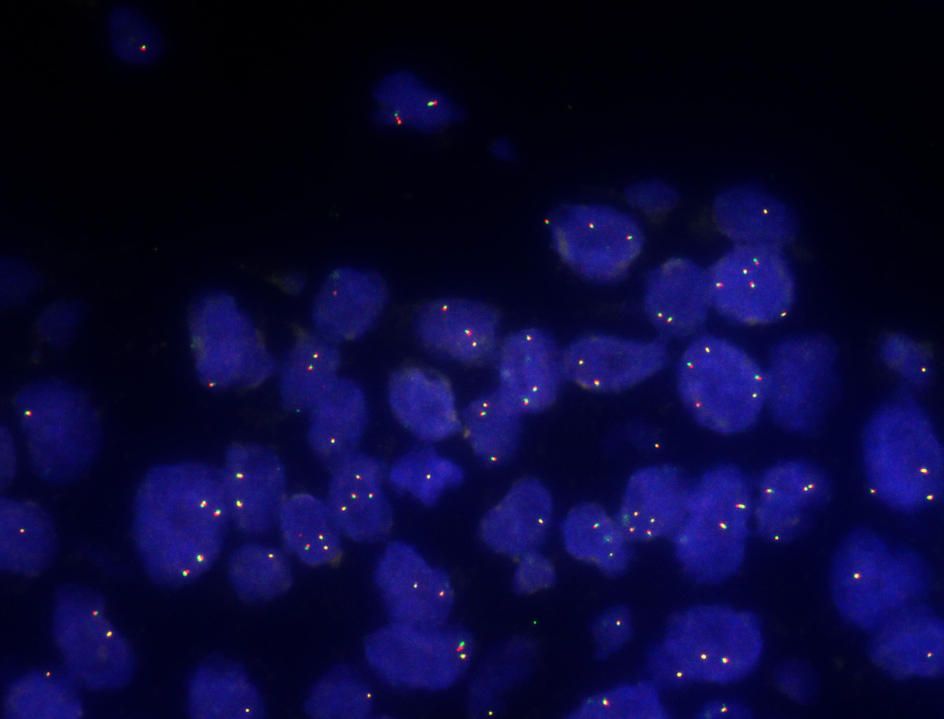 ALK-Lung Analyte Control - HistoCyte