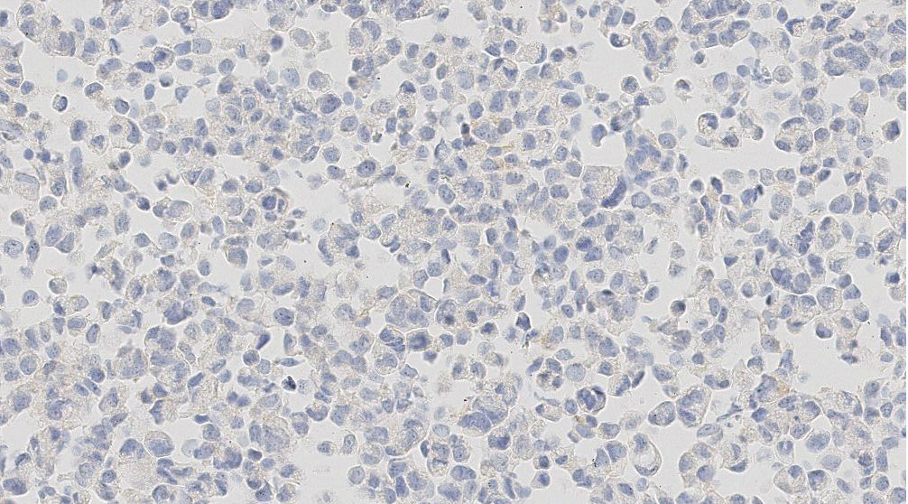 Breast Analyte ControlDR - HistoCyte