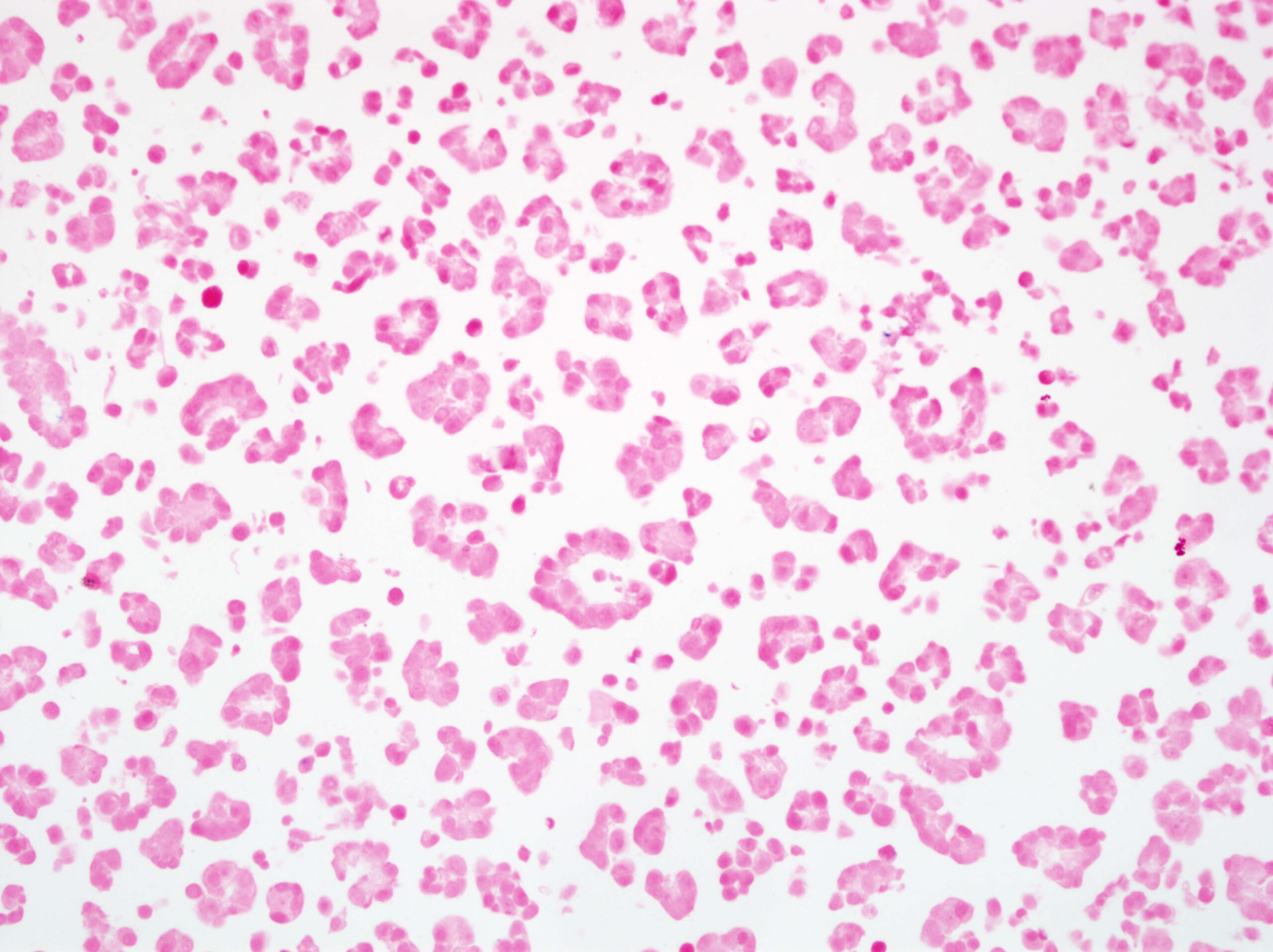 HPV/p16 Analyte Control - HistoCyte