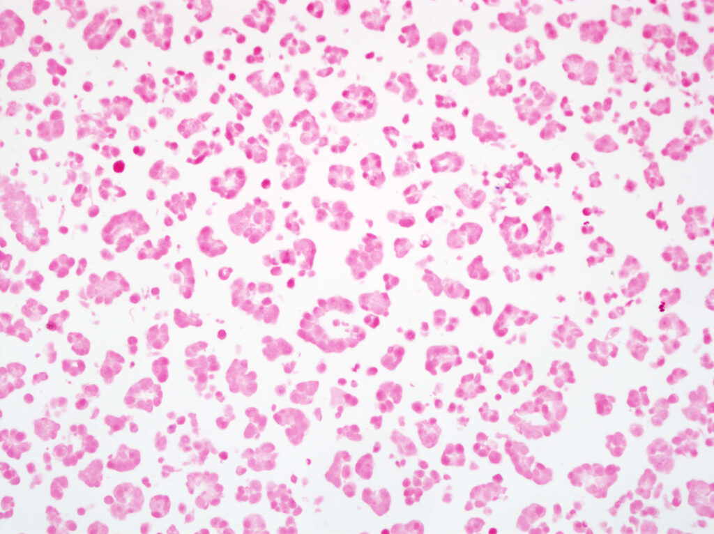 HPV/p16 Analyte ControlDR - HistoCyte