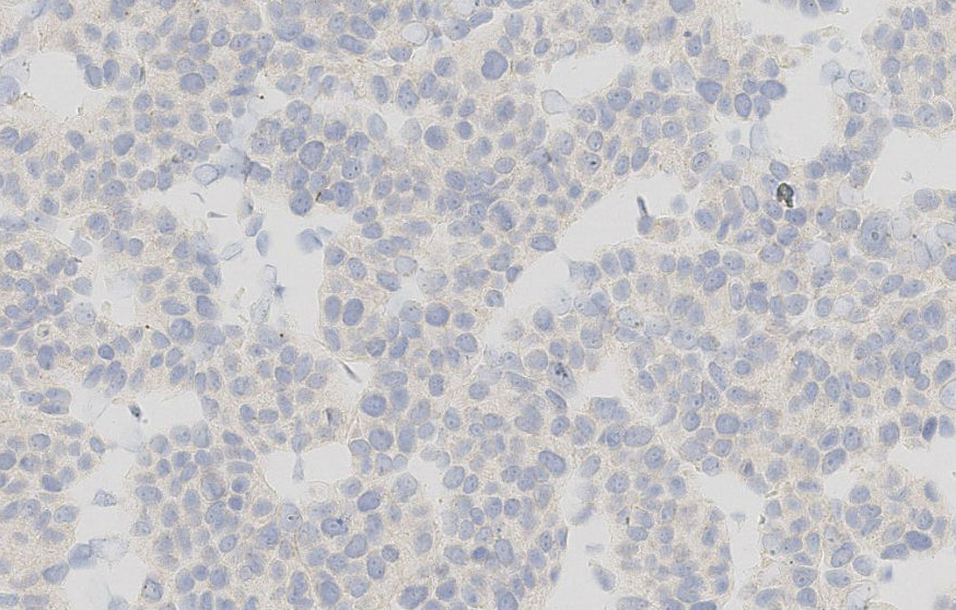 ALK-Lung Analyte Control - HistoCyte