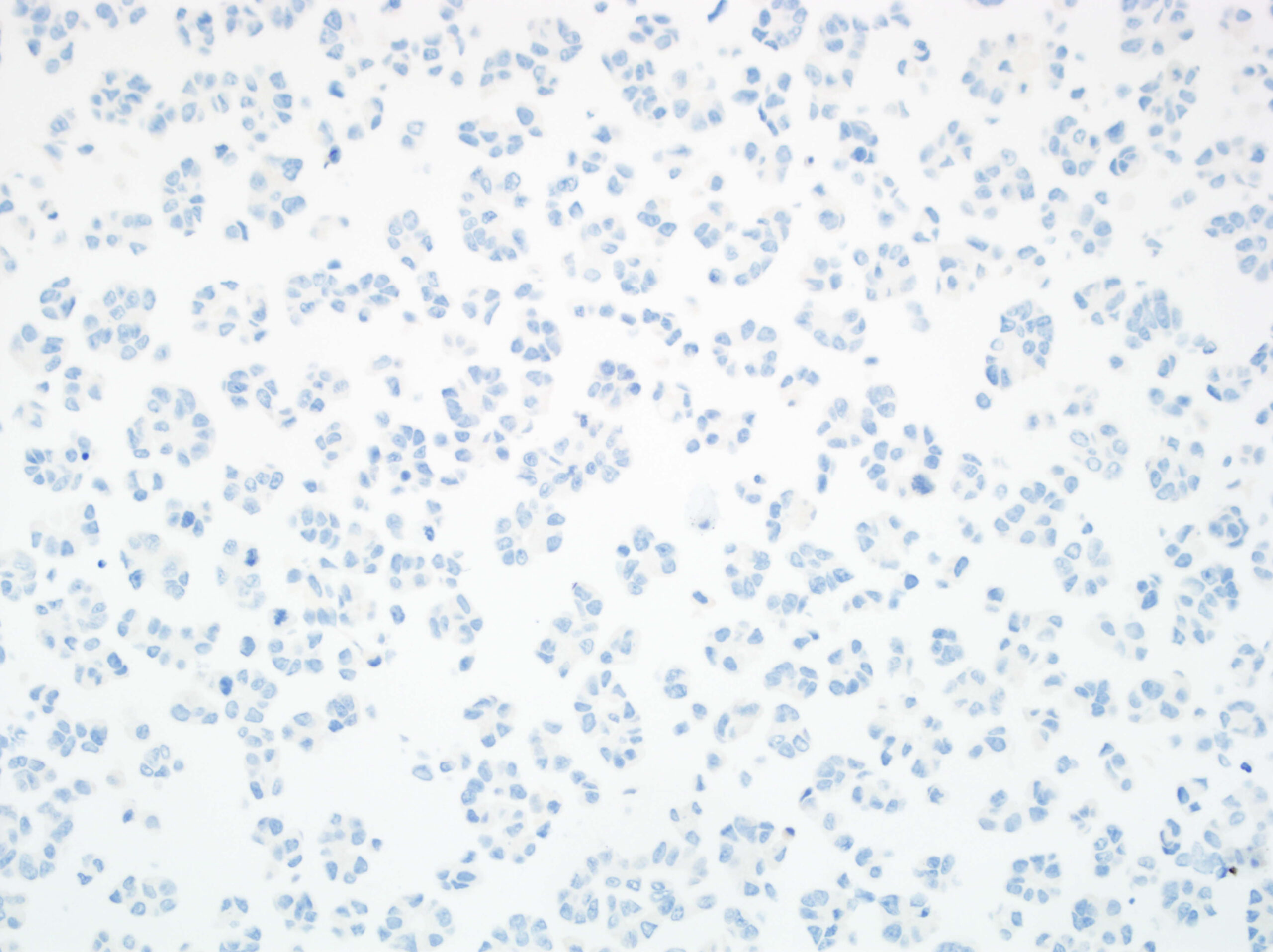 HPV/p16 Analyte ControlDR - HistoCyte