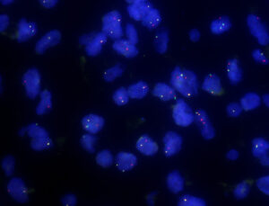 ALK-Lung Analyte Control - HistoCyte