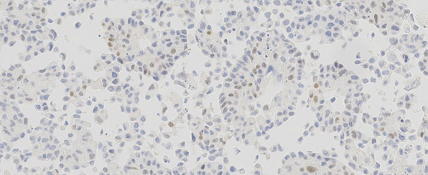 ER Analyte ControlDR - HistoCyte