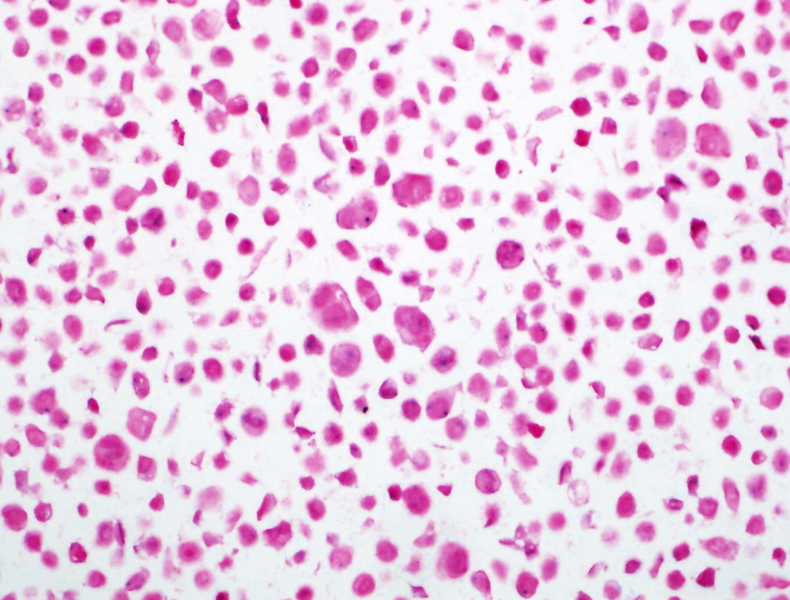 HPV/p16 Analyte ControlDR - HistoCyte