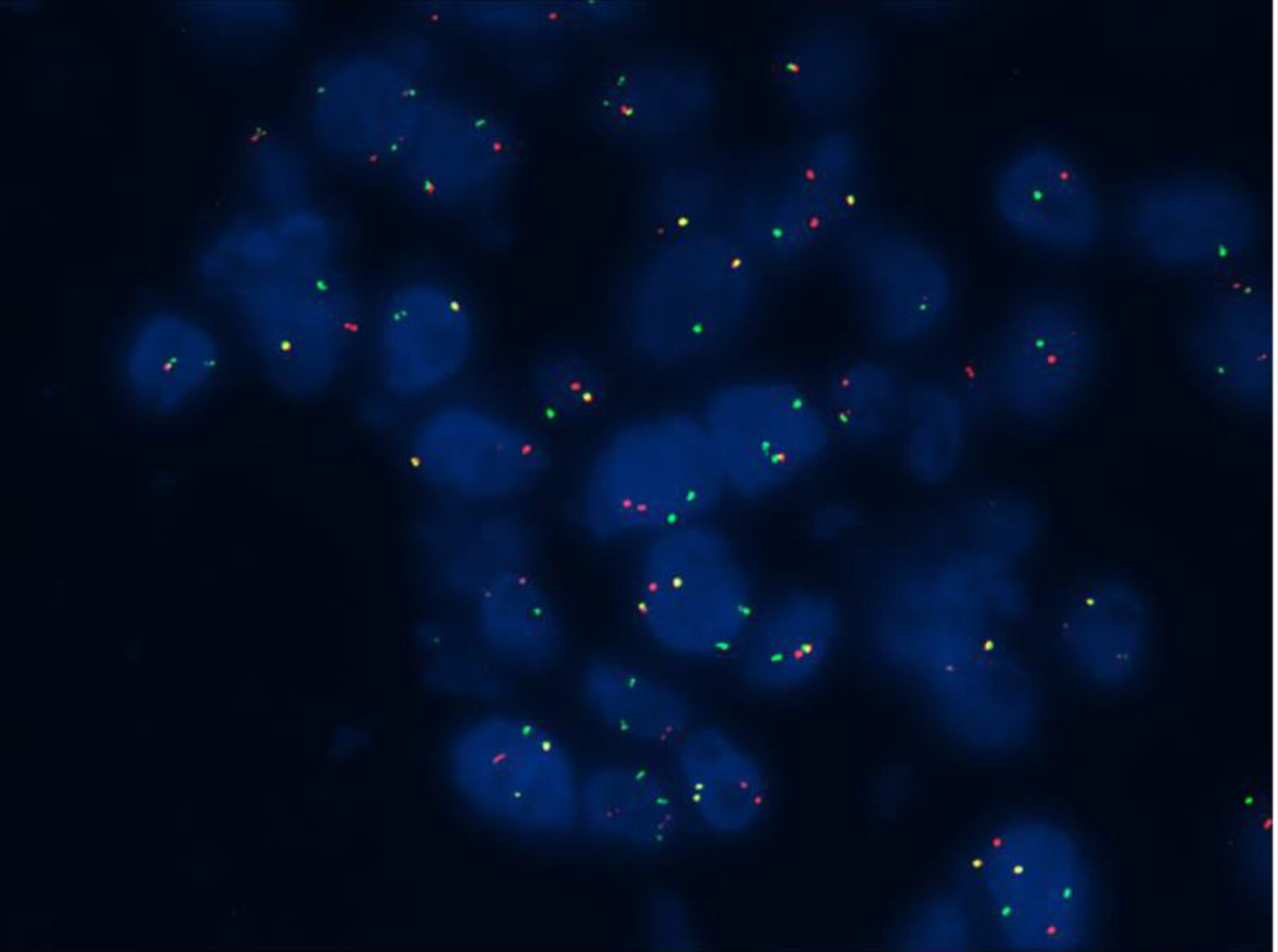 ROS1 Analyte Control - HistoCyte