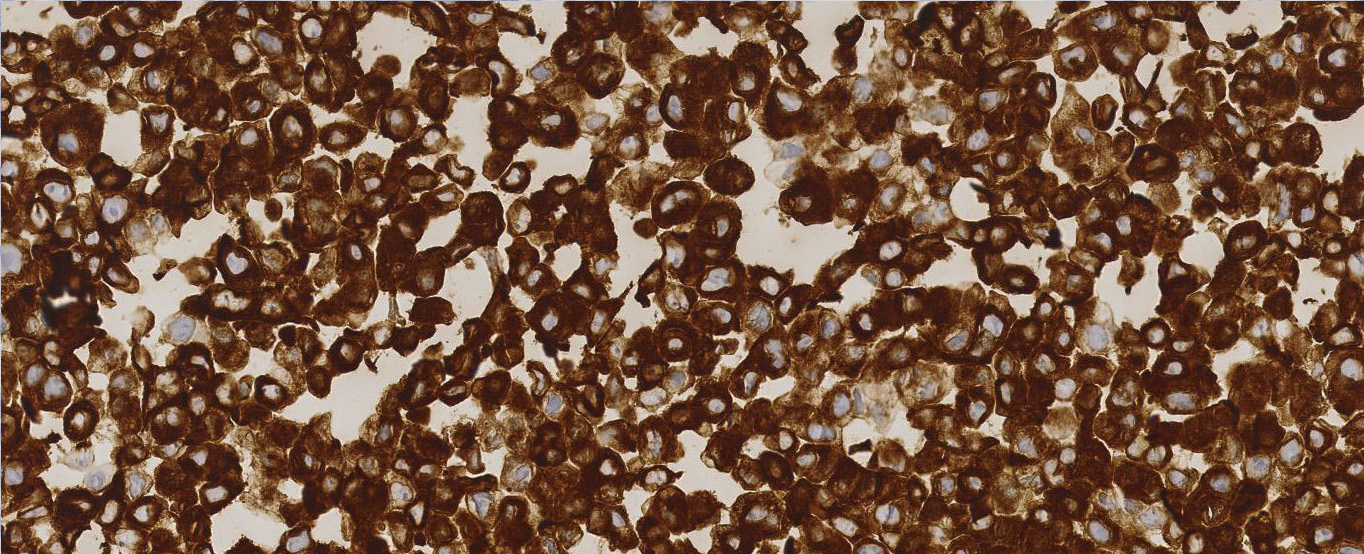 ROS1 Analyte Control - HistoCyte