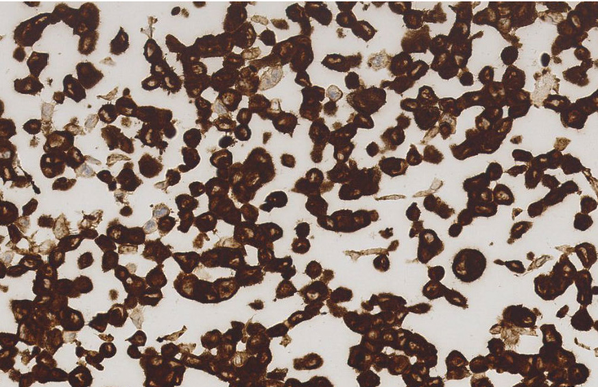 ALK-Lung Analyte Control - HistoCyte