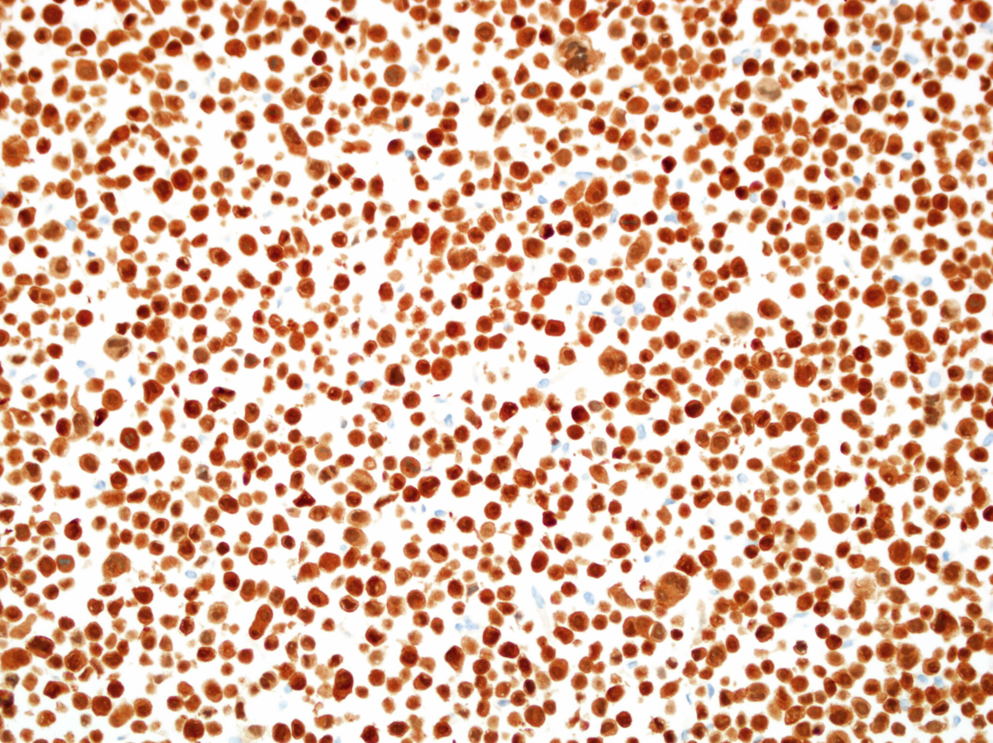 HPV/p16 Analyte ControlDR - HistoCyte