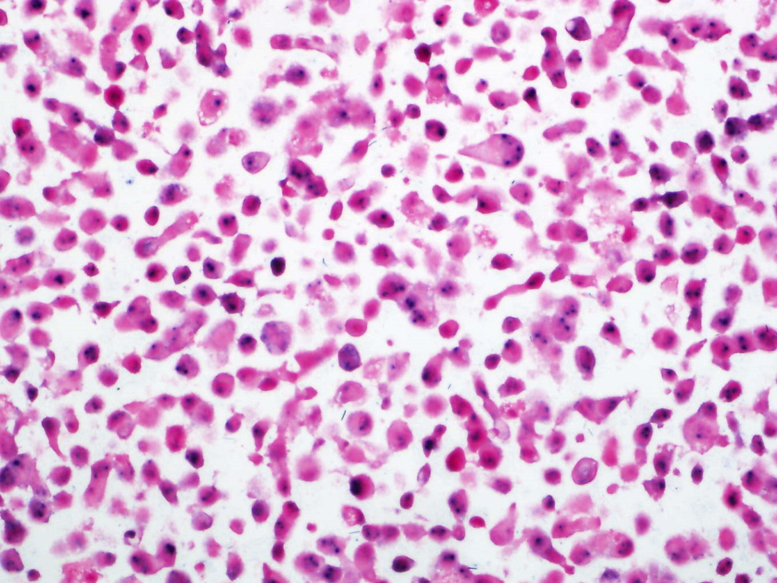 HPV/p16 Analyte ControlDR - HistoCyte