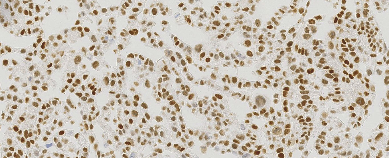 Breast Analyte ControlDR - HistoCyte