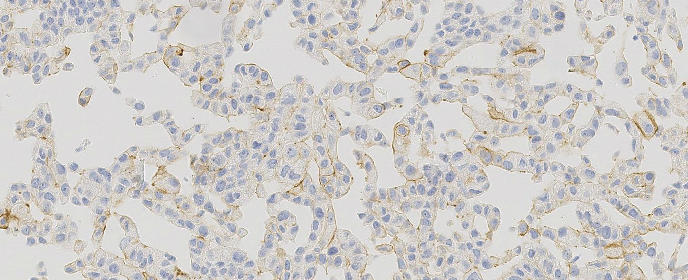 Breast Analyte ControlDR - HistoCyte