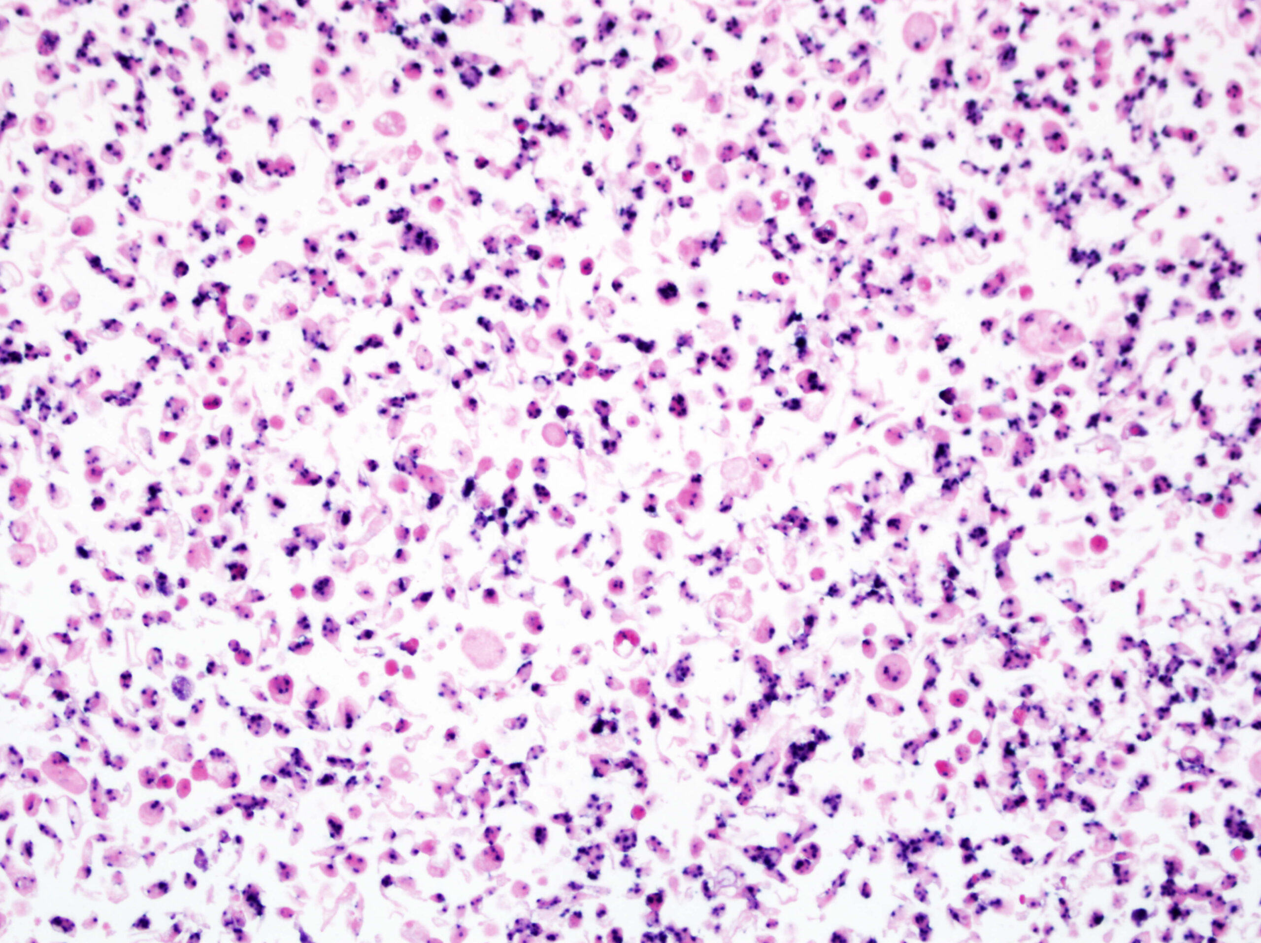 HPV/p16 Analyte Control - HistoCyte