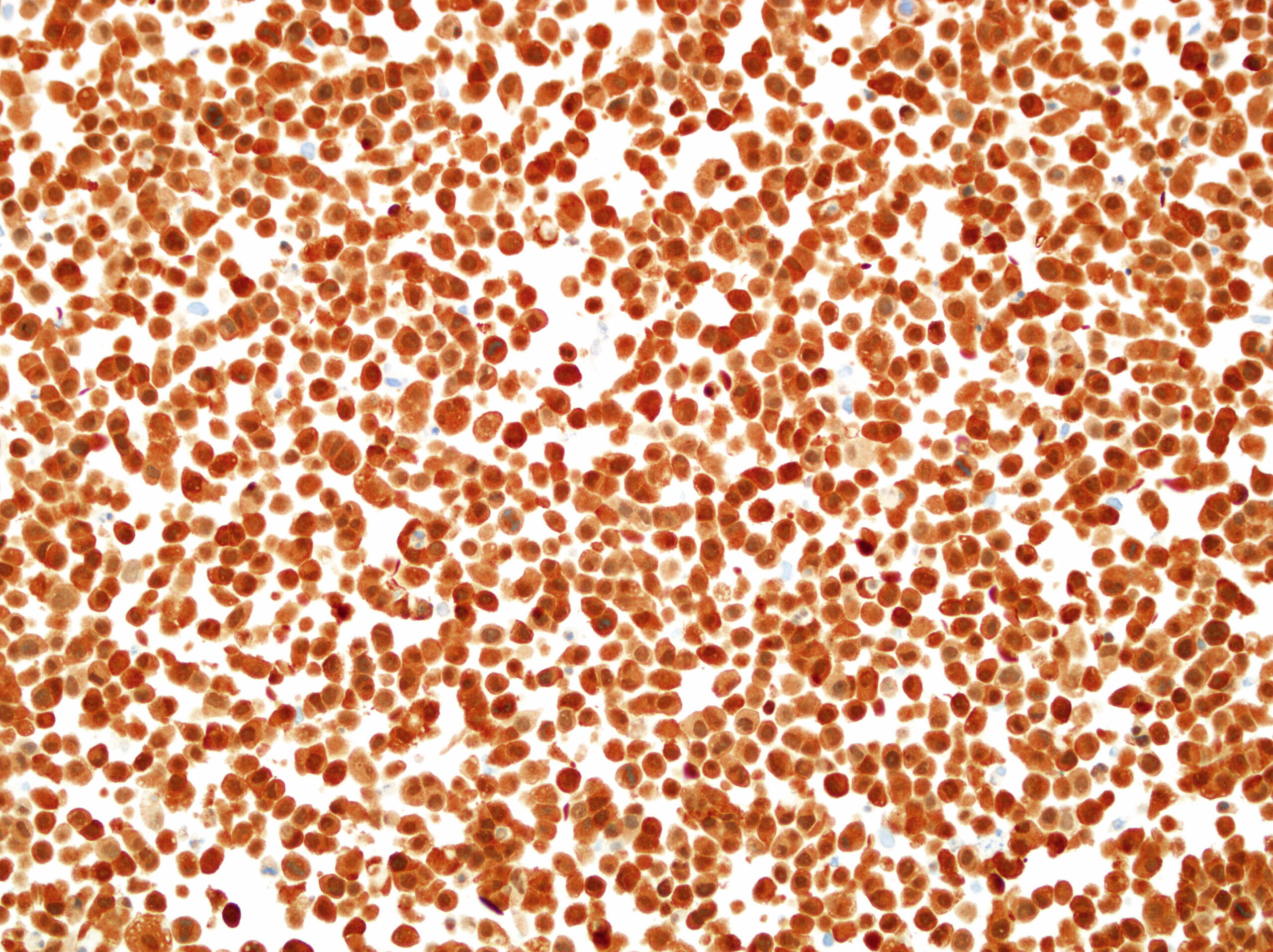 HPV/p16 Analyte ControlDR - HistoCyte