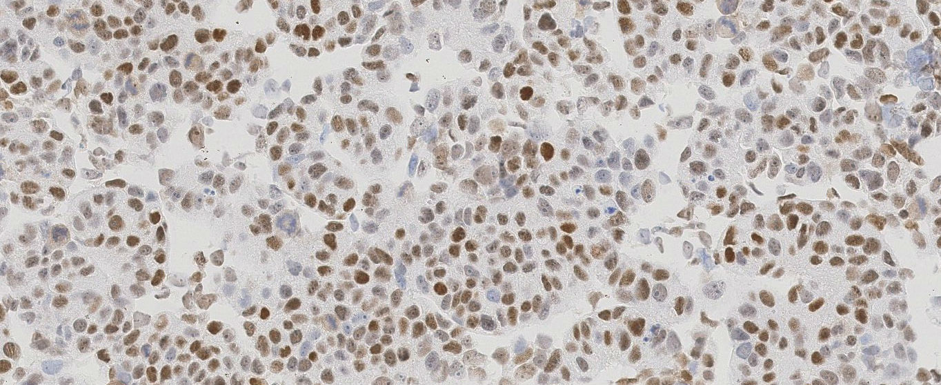 Breast Analyte ControlDR - HistoCyte