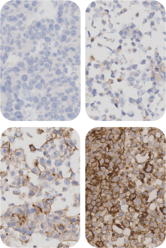PD-L1 Analyte ControlDR - HistoCyte