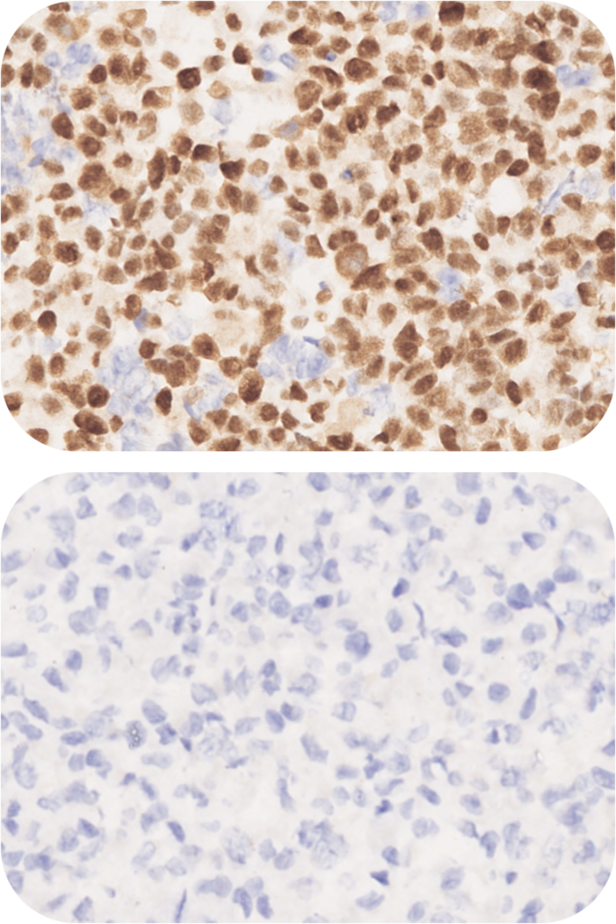 MLH1/PMS2 Analyte Control - HistoCyte