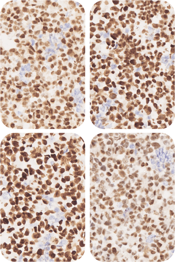 MMR Analyte Control - HistoCyte