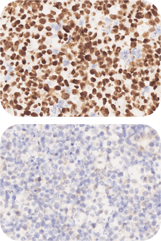 MSH2 Analyte Control - HistoCyte