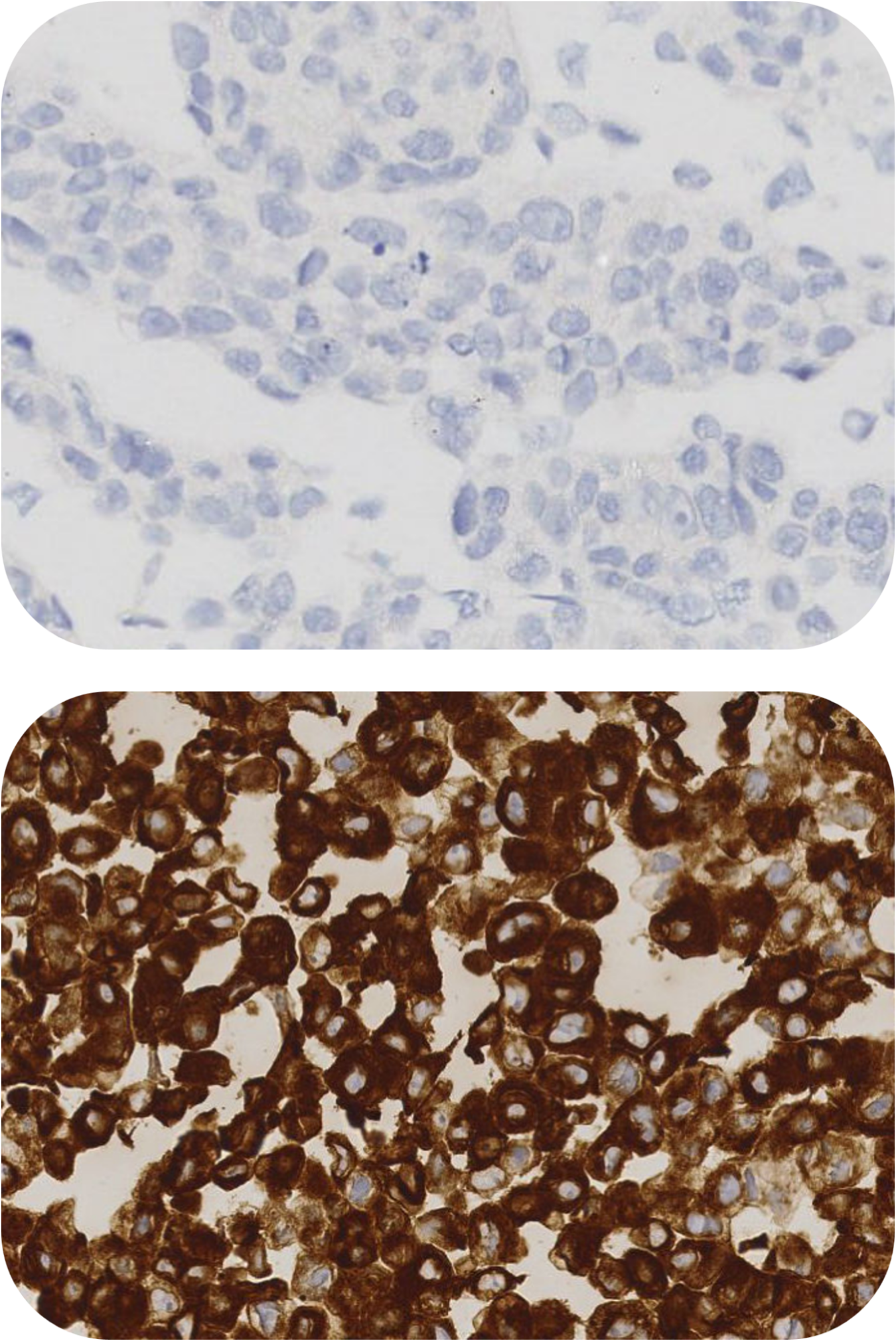 ROS1 Analyte ControlDR - HistoCyte