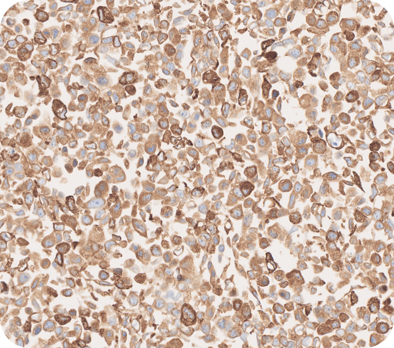 ROS1 Analyte ControlDR - HistoCyte