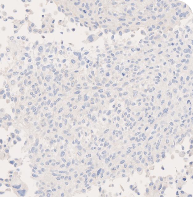 ROS1 Analyte ControlDR - HistoCyte