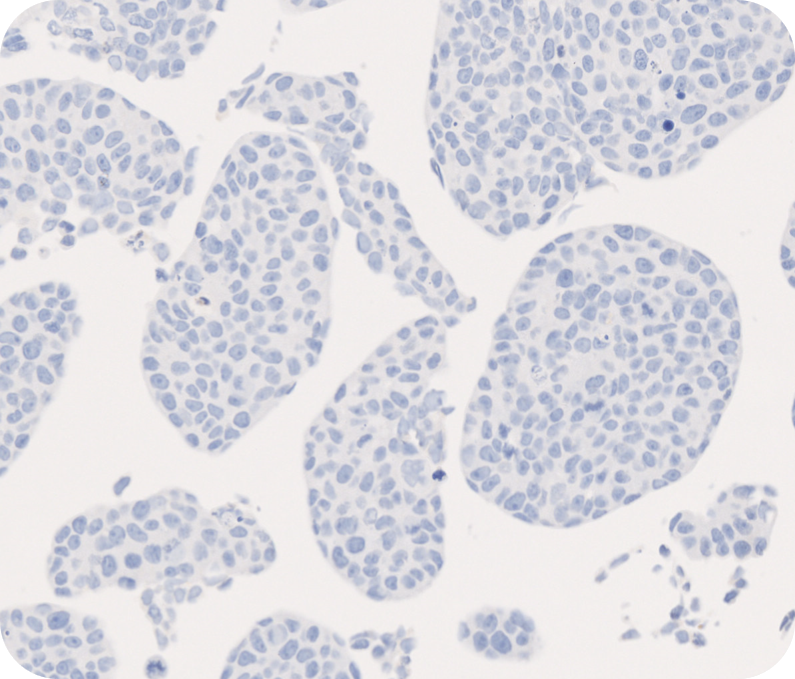 ROS1 Analyte ControlDR - HistoCyte
