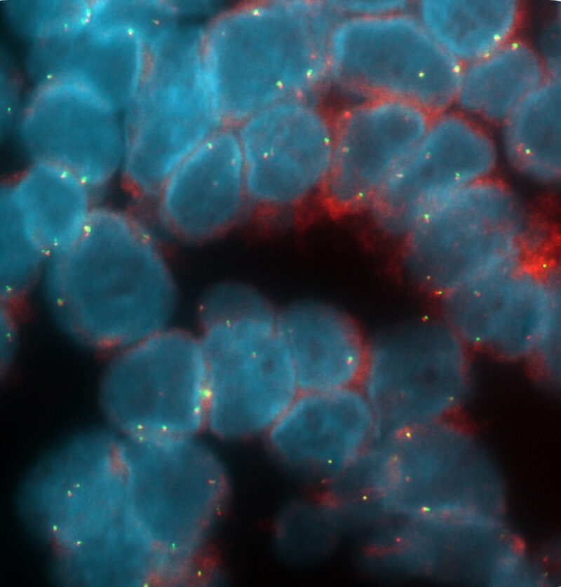 ROS1 Analyte ControlDR - HistoCyte