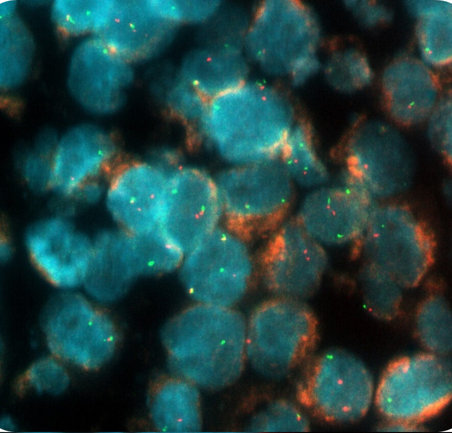 ROS1 Analyte ControlDR - HistoCyte
