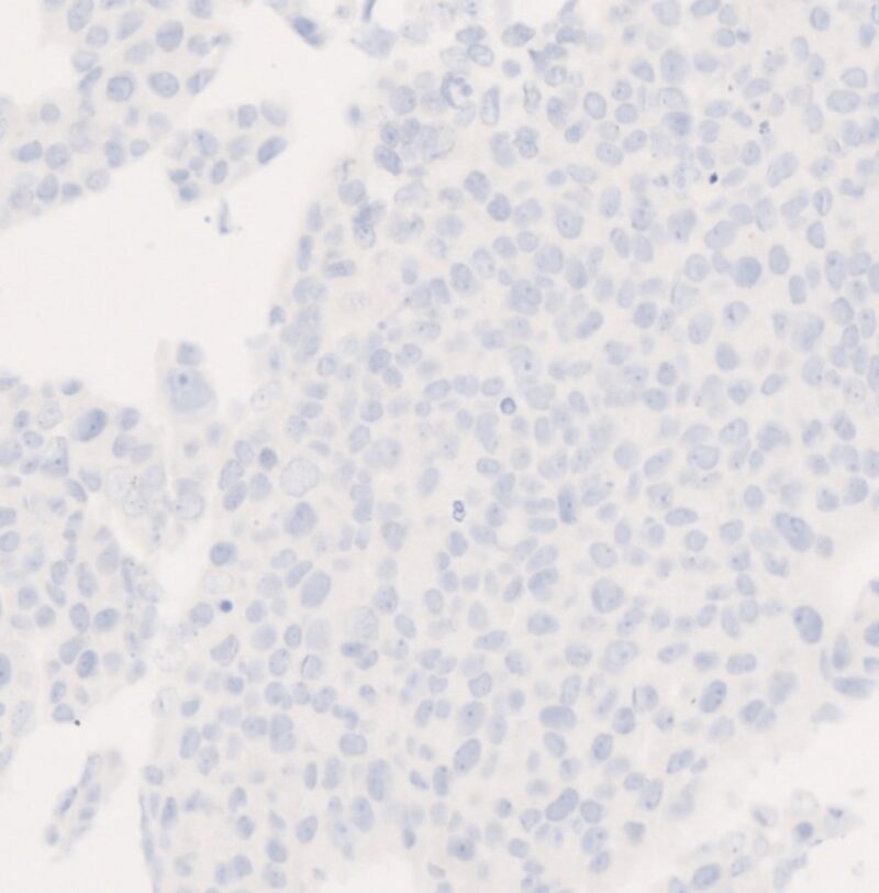 BRAF Analyte Control - HistoCyte