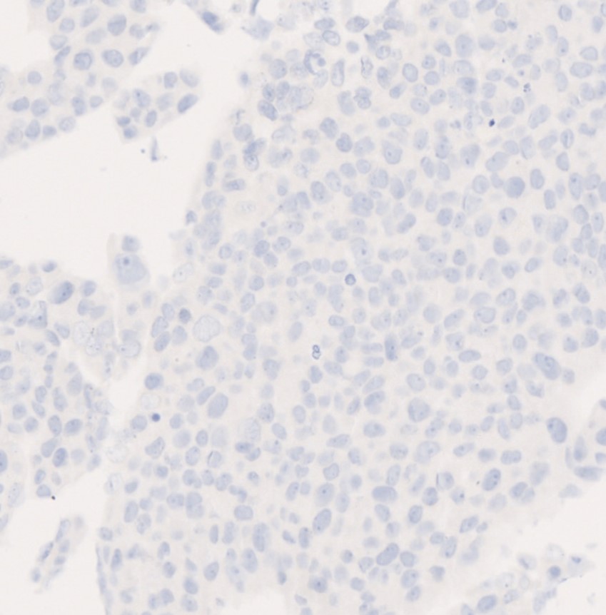 BRAF Analyte Control - HistoCyte